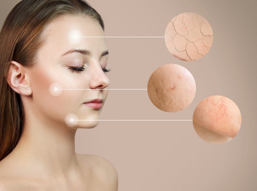 HOW DO WE DRINK WATER TO KEEP OUR BODY HEALTHY AND SKIN BEAUTIFUL ...