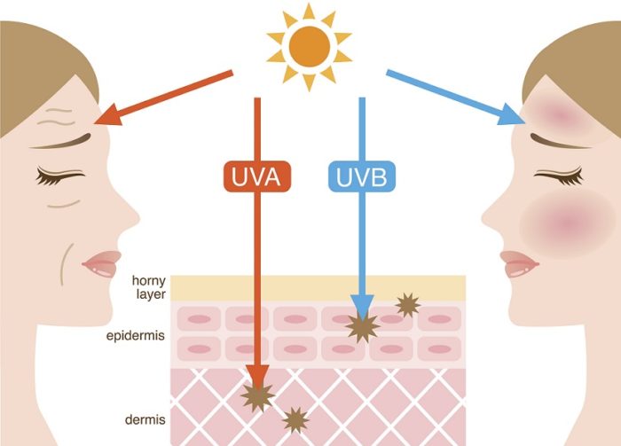 AGING SIGNS AND SOLUTIONS TO INTERVENE, PREVENT AND IMPROVE SKIN WITH ...